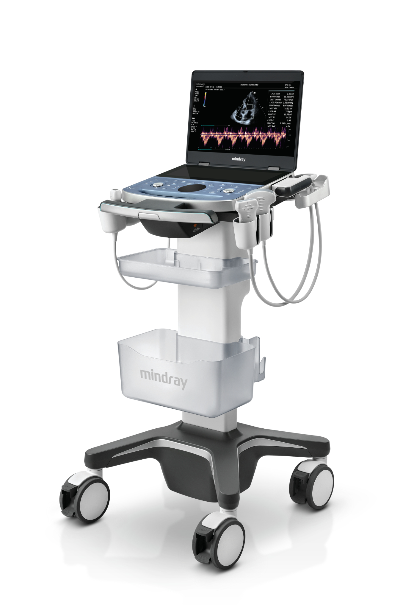 Mindray USG ME7 – PT. Dwitunggal Abadi Nusa