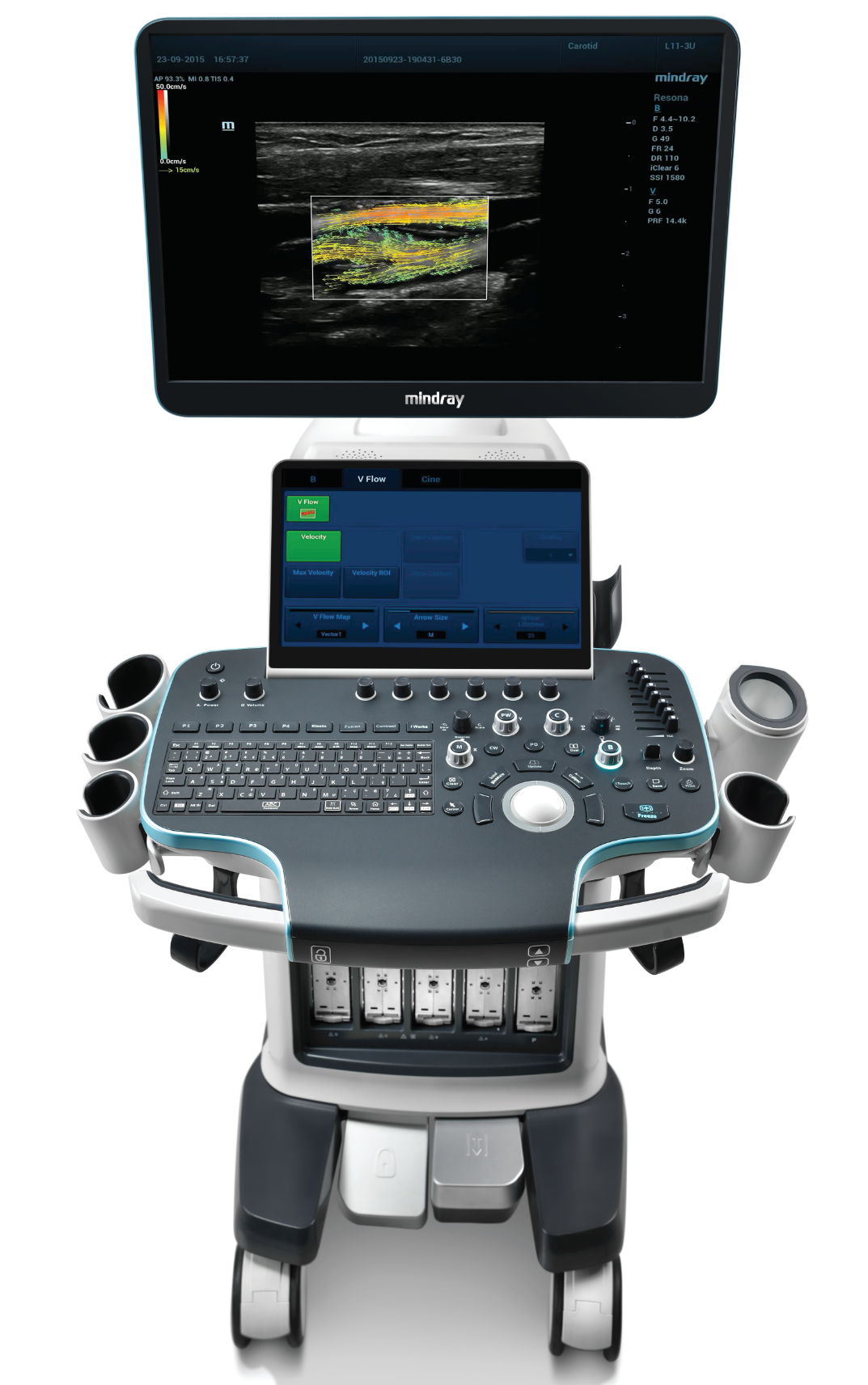 Mindray USG Resona R9 – PT. Dwitunggal Abadi Nusa