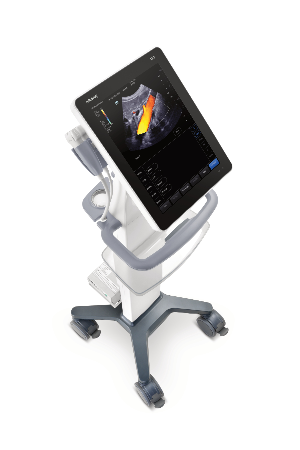 Mindray USG TE7 – PT. Dwitunggal Abadi Nusa